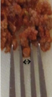 Level 5: Minced and moist food - Leeds Community Healthcare