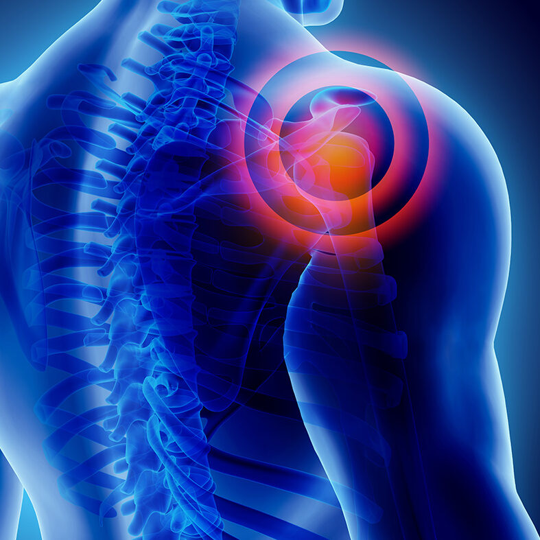 Known and diagnosed shoulder problems - Leeds Community Healthcare