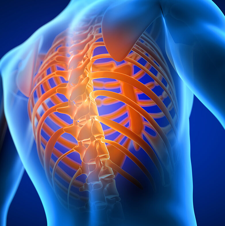 Known and diagnosed back problems - Leeds Community Healthcare