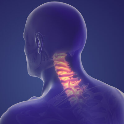 Neck problems - Leeds Community Healthcare