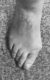 Foot pain - Leeds Community Healthcare