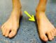 Foot pain - Leeds Community Healthcare